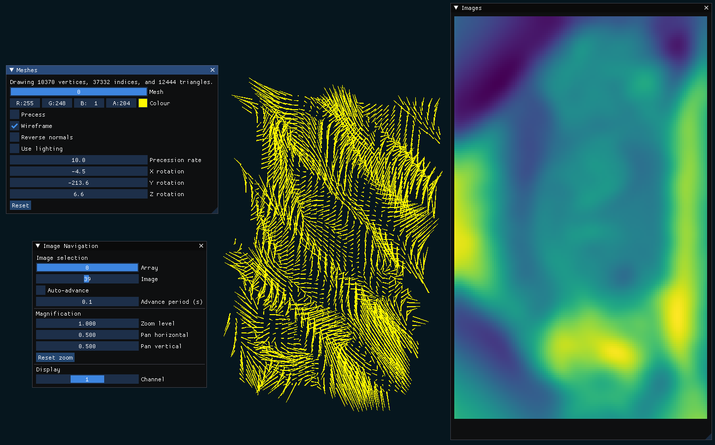 DICOMautomaton Deformation Visualization